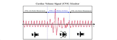 Motion Induced Artifacts In Cardiac Volume Monitoring Using Eit Download Scientific Diagram