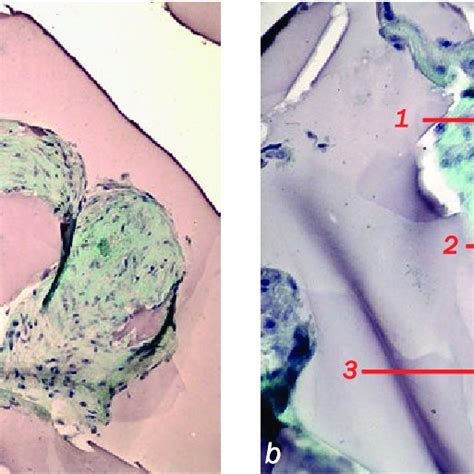 Sample No 2 Culturing For 24 Days In Stempro Differentiation Medium Download Scientific