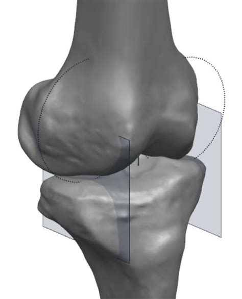 Schematic Representation Of Tibia Sagittal A Coordination B Medial