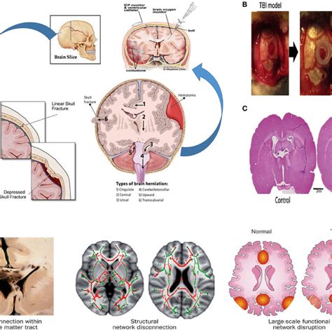 A The Mesengenic Process Typical Lineages Of Mesenchymal Stem Download Scientific Diagram