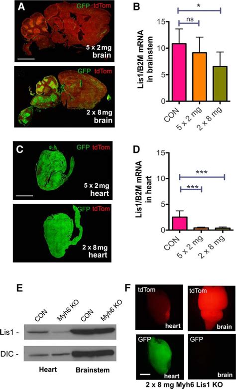 An Essential Postdevelopmental Role For Lis1 In Mice ENeuro