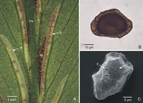 Sori And Spores Of Asplenium Achalense A Abaxial Surface Of A Pinnae