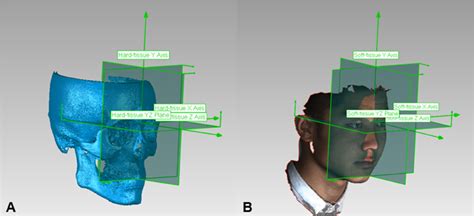The Three Dimensional Coordinate System Of Hard Tissue A And