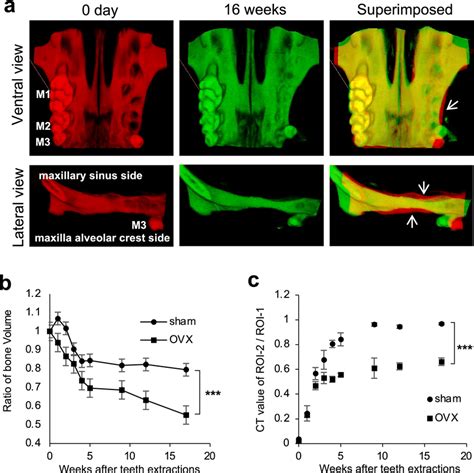 Ovariectomy Prolongs Maxillary Bone Resorption After Teeth Extractions Download Scientific