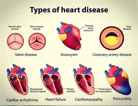 Pin On Health Is Wealth