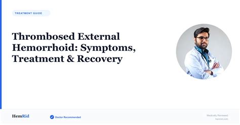 Thrombosed External Hemorrhoid Symptoms Treatment And Recovery