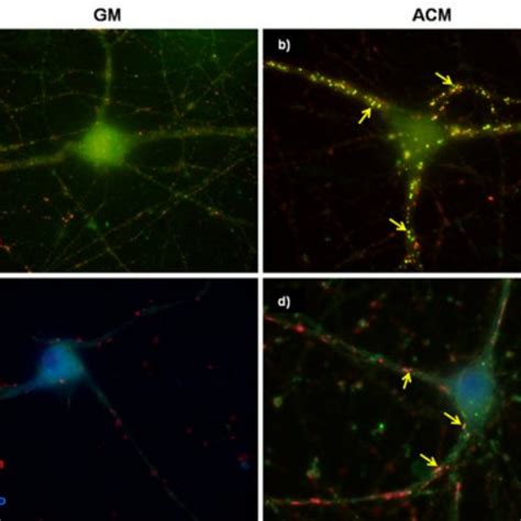Quantification Of Synapse Number Using Puncta Analyzer Shown Here Is
