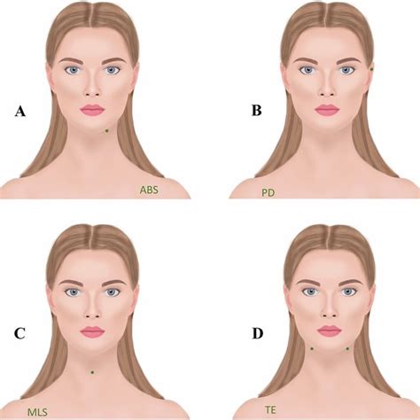 Examples Of The Marking Procedures For Each Procedure The Download Scientific Diagram