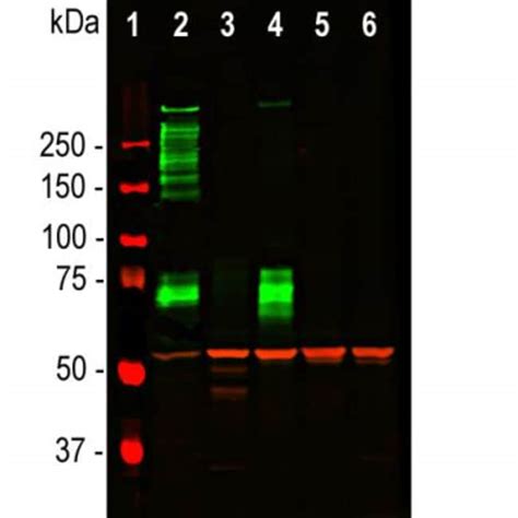 Vimentin Antibody Novus Biologicals 0025ml Unlabeledantibodies