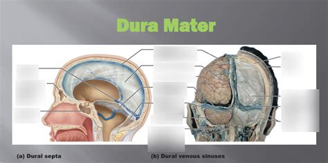 Dura Mater Diagram Quizlet