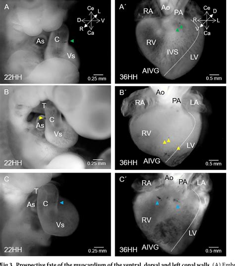 Figure 3 From The Proximal Segment Of The Embryonic Outflow Conus