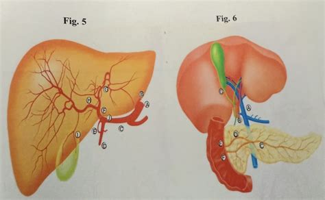 ARRT VI Diagram Quizlet