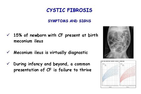 Cystic Fibrosis Is A Complex Metabolic Disorder Characterized
