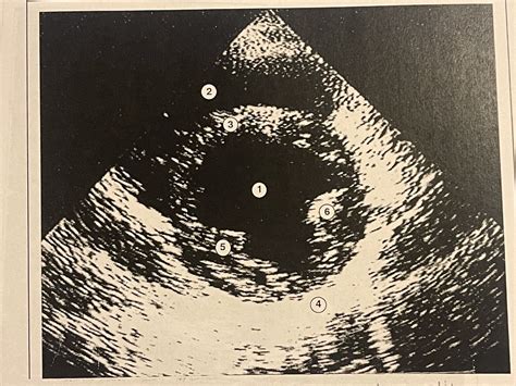 Echo 1100 Vocabulary Flashcards Flashcards Quizlet