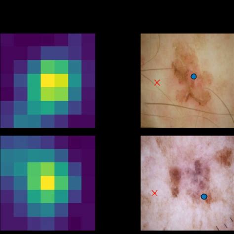 Attention Maps Before And After Our Feature Selection Using A Few Download Scientific Diagram