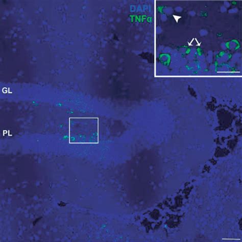 Immunofluorescence assay of TNFα in the dentate gyrus of rodents Download Scientific Diagram