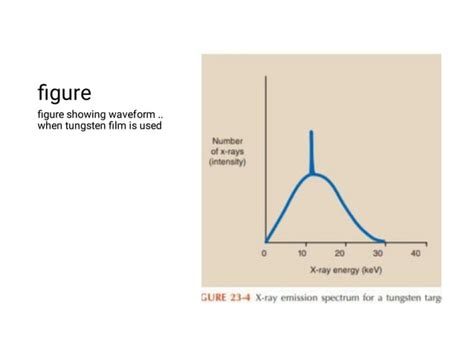 Mammography Radiologypdf