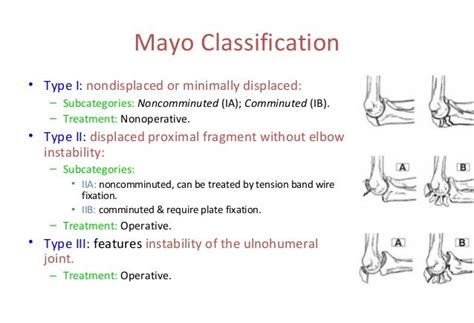 Mayo Classification System Of Olecranon Fractures