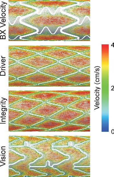 Figure 1 From Computational Fluid Dynamics Evaluation Of Equivalency In Hemodynamic Alterations