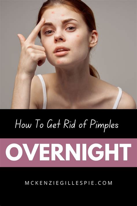 Ways To Get Rid Of Pimples Overnight Fast Artofit