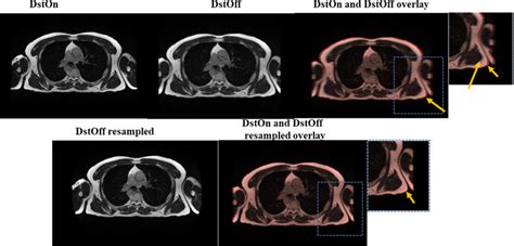 The Axial View Of The Human Chest Mr Image Acquired At Gantry 300° Download Scientific Diagram