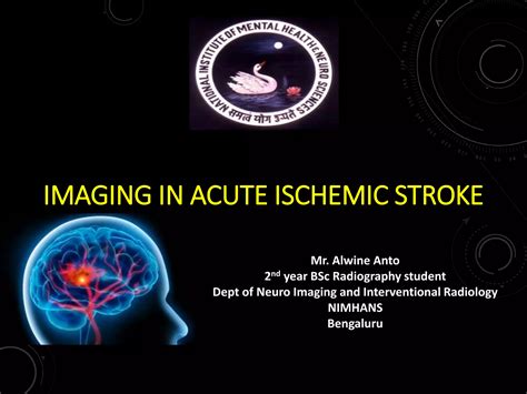 Imaging In Acute Stroke Pptx