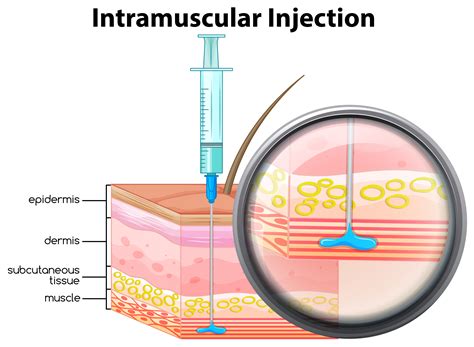 Intramuscular Injections Transhub