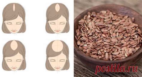 11 ранних предупреждающих знаков того что уровни эстрогена слишком вы Журнал для женщин Постила