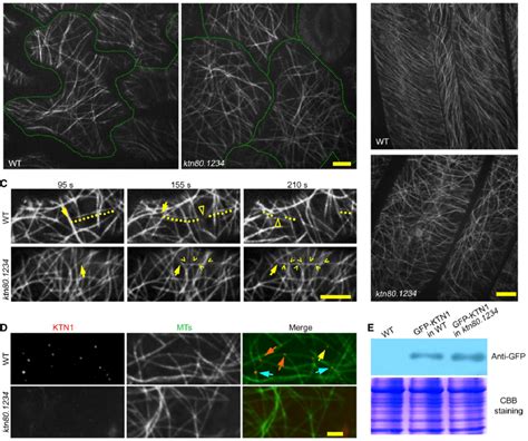The Ktn80 1234 Quadruple Mutants Display Abnormal Mt Organization Download Scientific Diagram
