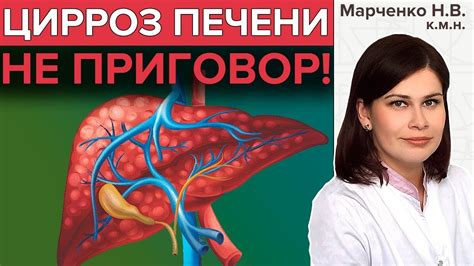 ЦИРРОЗ ПЕЧЕНИ Признаки лечение Что такое цирроз печени Youtube