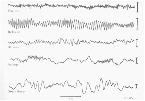 Sample EEG Signal Download Scientific Diagram