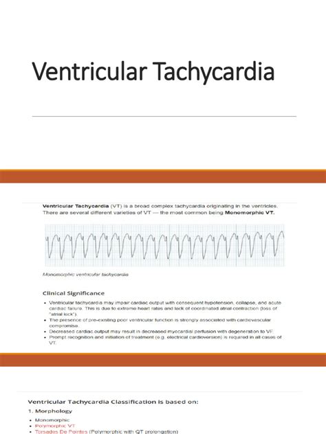 Ventricular Tachy Pdf