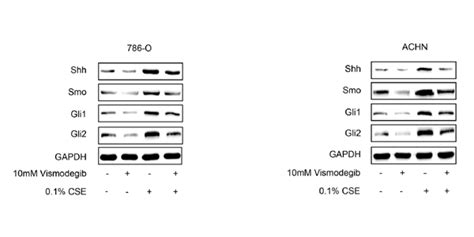 Vismodegib Gdc 0449 Hedgehog Inhibitor Medchemexpress