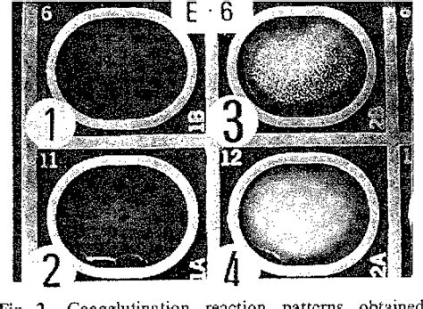Figure 2 From A Coagglutination Test With Antibody Sensitized