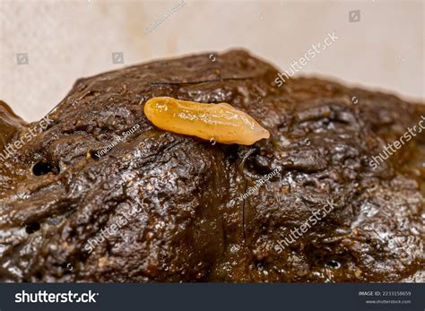 Tapeworm Proglottids In Human Stool