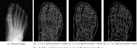 Figure 3 From Edge Detection Using Spectral Intrinsic Decomposition Semantic Scholar