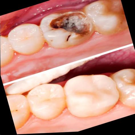 Task24 Object Detection Dataset By Nckh Task7