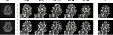 Generative Adversarial Networks With Adaptive Normalization For