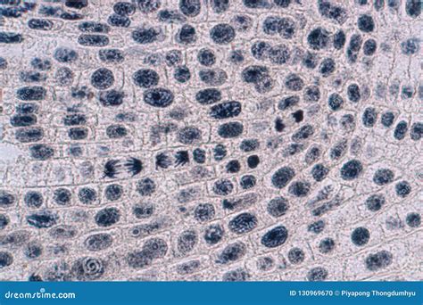 Mitosis Cell In The Root Tip Of Onion Under A Microscope Royalty Free