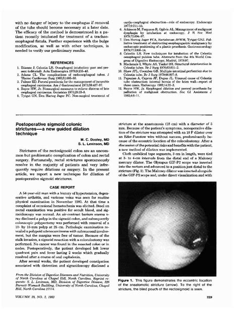 Pdf Postoperative Sigmoid Colonic Strictures—a New Guided Dilation