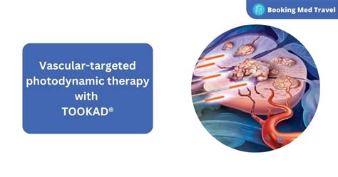 Vascular Targeted Photodynamic Therapy With Tookad®