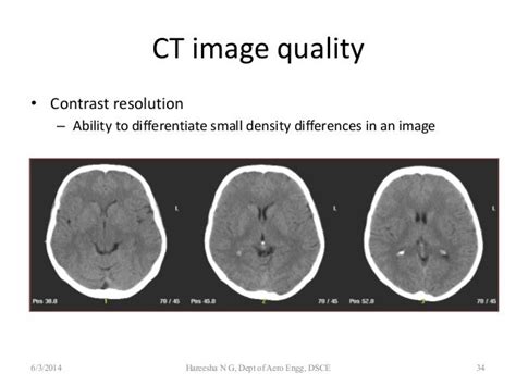 Basic Principles Of Ct Scanning