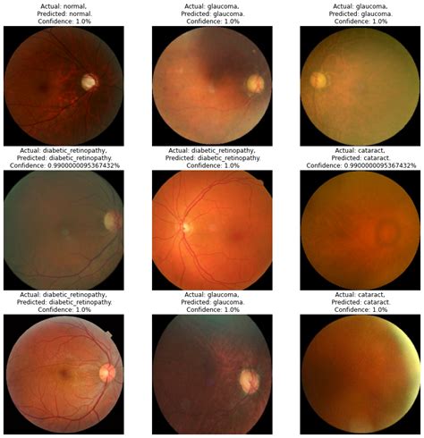 GitHub Mohamedbakrey Classification Eye Diseases And Deployment Projects