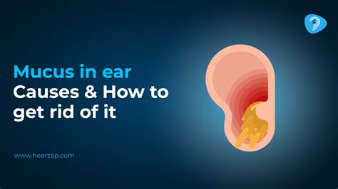 Swollen Lymph Nodes Behind Ear Causes And Treatment