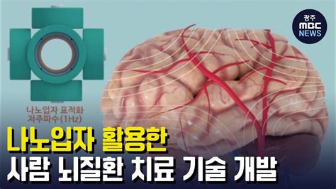 뉴스데스크 나노입자 활용한 사람 뇌질환 치료 기술 개발 Youtube