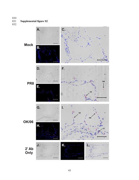 Innate Immune Response To H3n2 And H1n1 Influenza Virus Infection In A