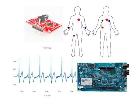 ecg using intel edison and plotly 6 steps instructables