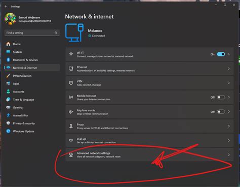 Pfsense Direct Connection Networking Level1techs Forums
