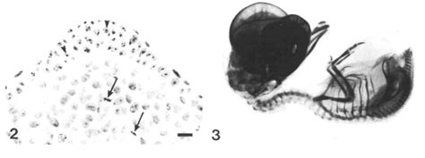 Figure From Initial Limb Budding Is Independent Of Apical Ectodermal Ridge Activity Evidence