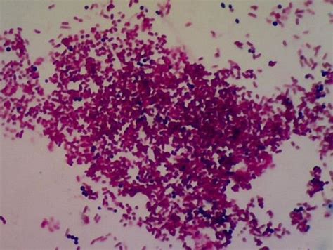 Pasteurella Multocida Gram Stain